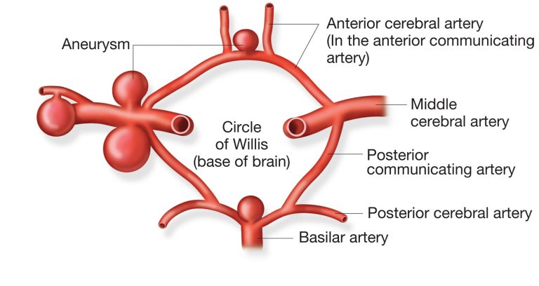 Circle of Willis - Location, Anatomy, Function and FAQs